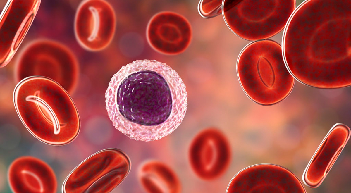 Managing Blood Cancer: Essential Tips for Care and Treatment